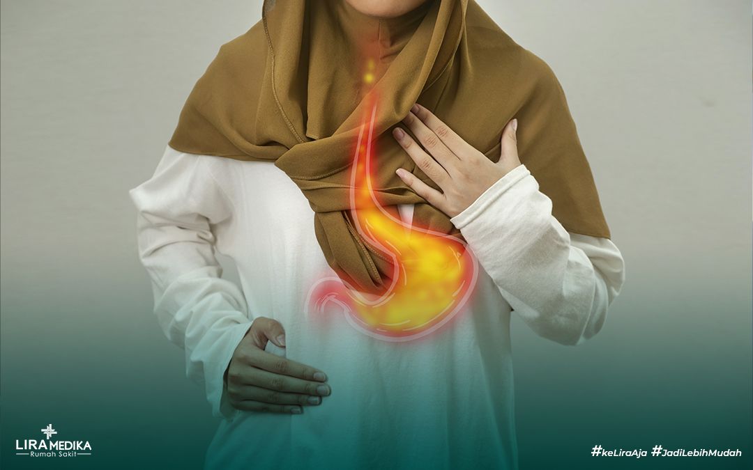 Bedanya GERD Dan Maag Biasa