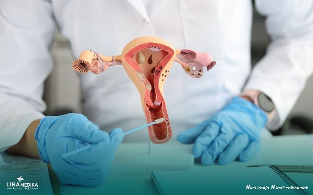 Pentingnya Pap Smear untuk Mencegah Kanker Serviks