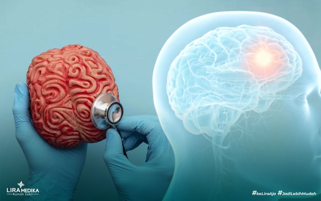 Pengenalan Tumor Otak: Jenis dan Gejala Awal