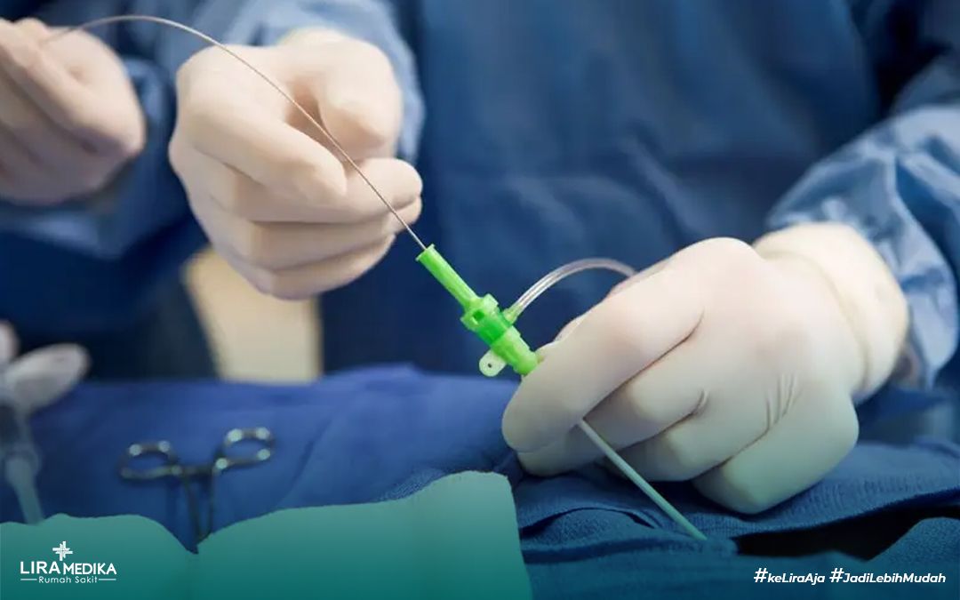 Apa yang Harus Diperhatikan Setelah Pemasangan Ring Jantung?