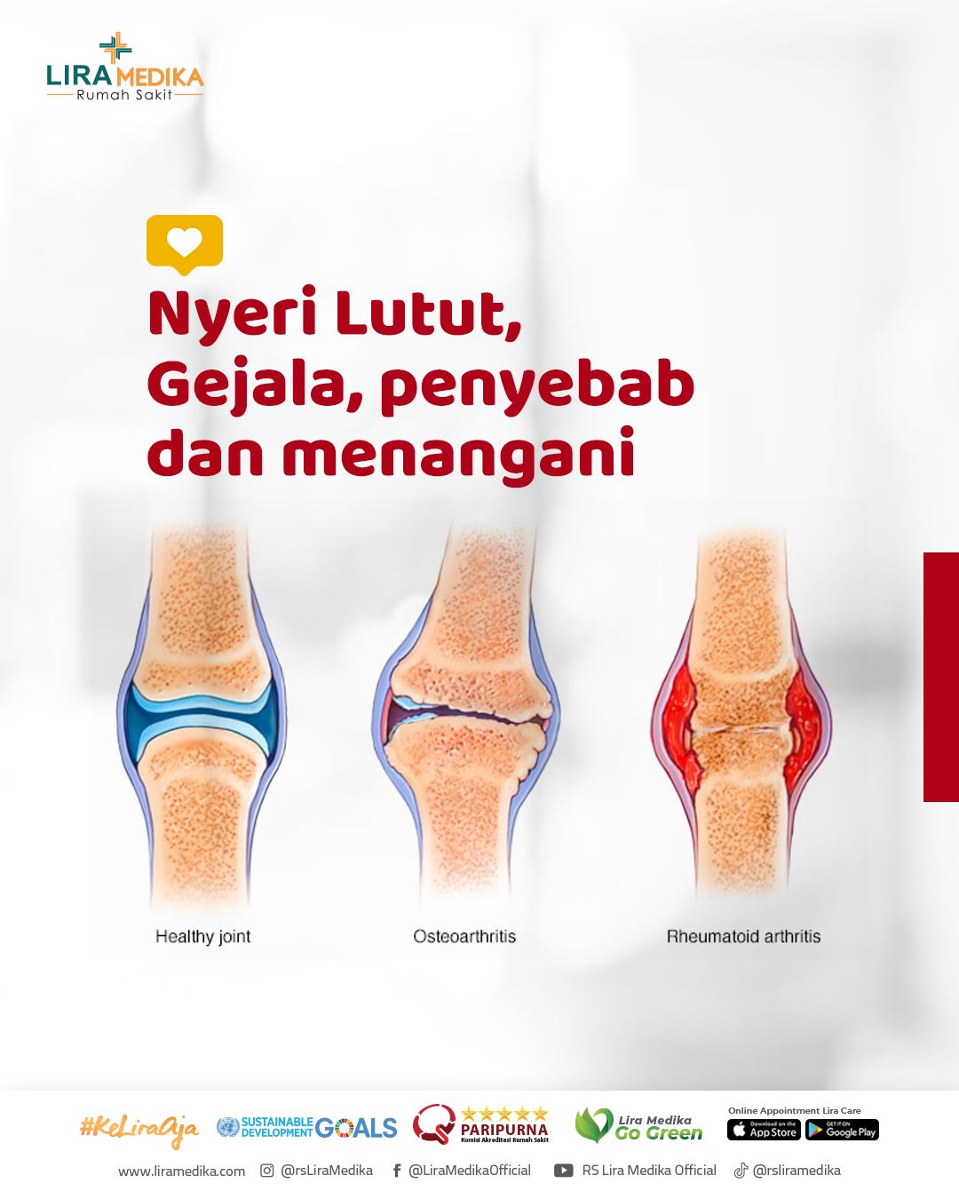 Seputar Sakit Lutut