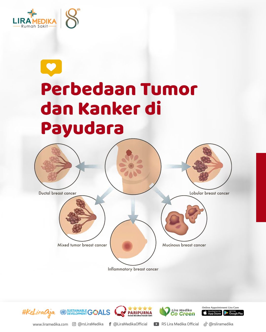 Perbedaan Tumor dan Kanker di Payudara