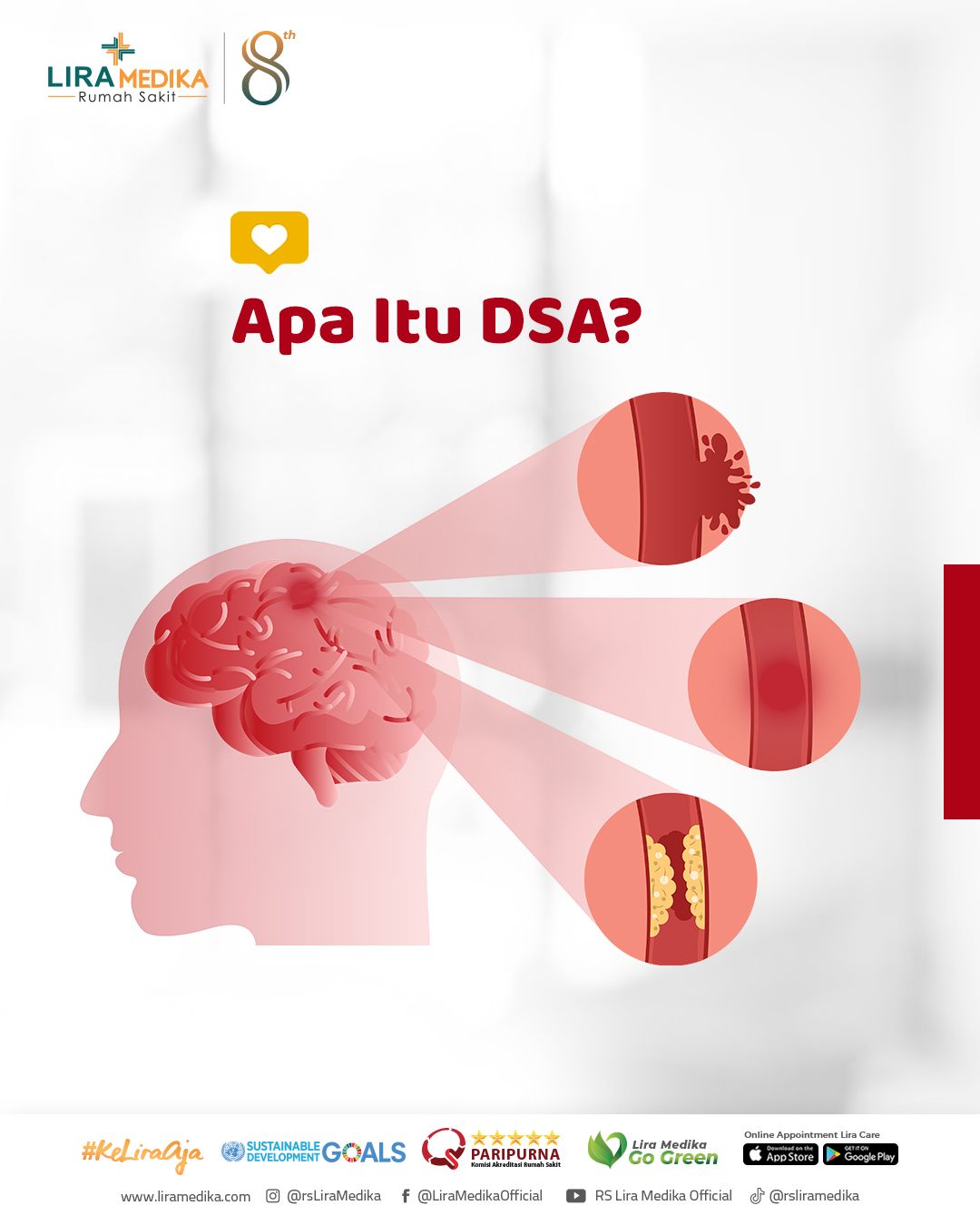 Apa itu DSA?