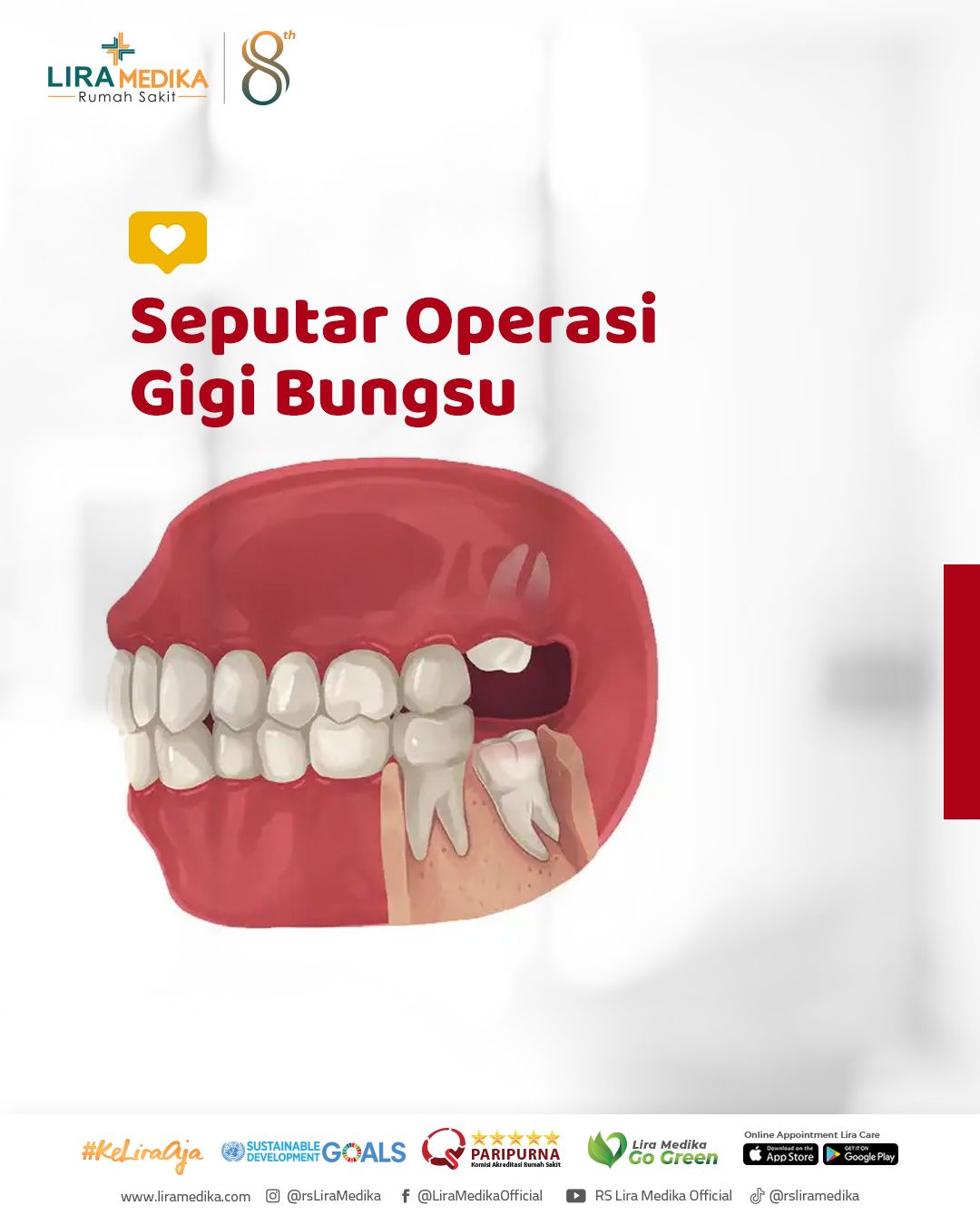 Seputar Gigi Bungsu